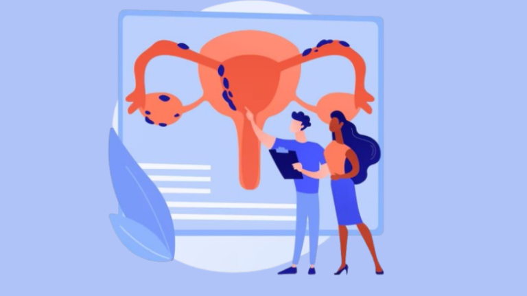 Common Gynecological Issues: Endometriosis, Fibroids & PCOS